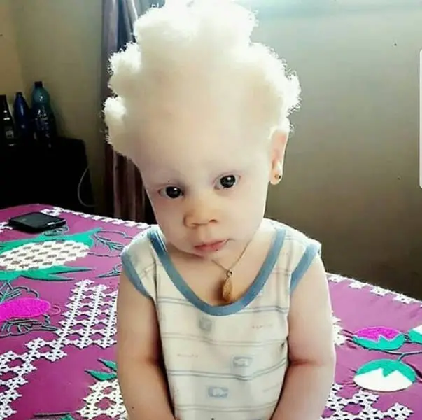 Así lucen los ALBINOS alrededor del mundo [15 Fotos] | Notinerd